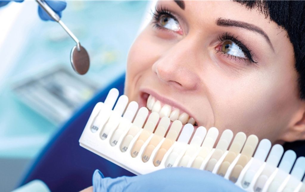 The GLO Science Teeth Whitening And Why Use It – Good Things Review